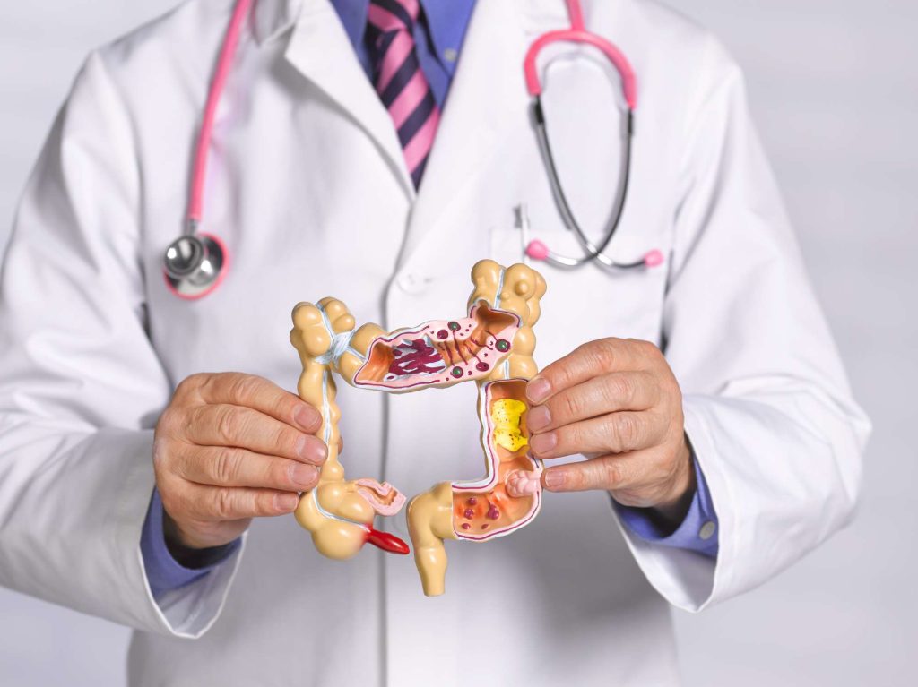 Colon Diseases Symptoms - Colon Rectal